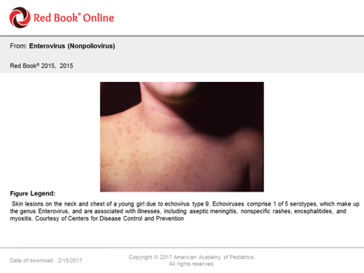Viral Exanthem Children s Mercy Kansas City viral-exanthem-children-s-mercy-kansas-city